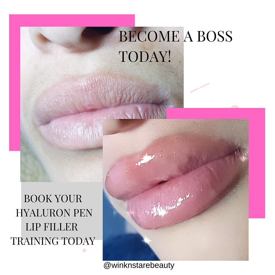 Advanced Hylauron Pen Training on Lips, Facial Wrinkles & Fat ...