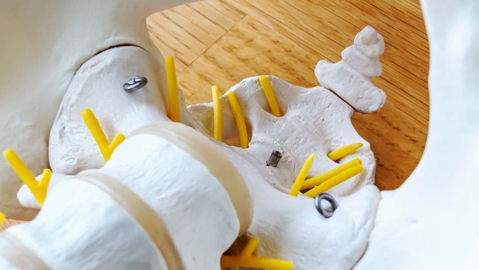 Level 1+ - Coccygodynie/Stuitpijn, THIM ALP - Advanced Learning ...