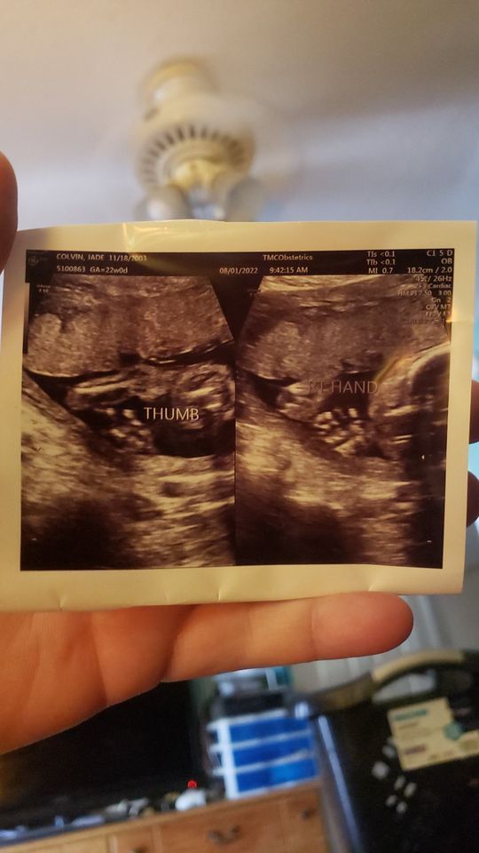 Omgoodness Its a Baby! Congratulations to Jade and Jovani, Lakeside ...