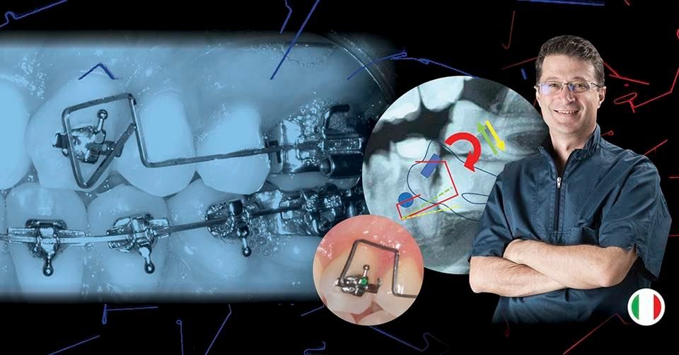 Биомеханика при сложни ортодонтски случаи, HOTEL SPS, PLOVDIV, 26 May ...